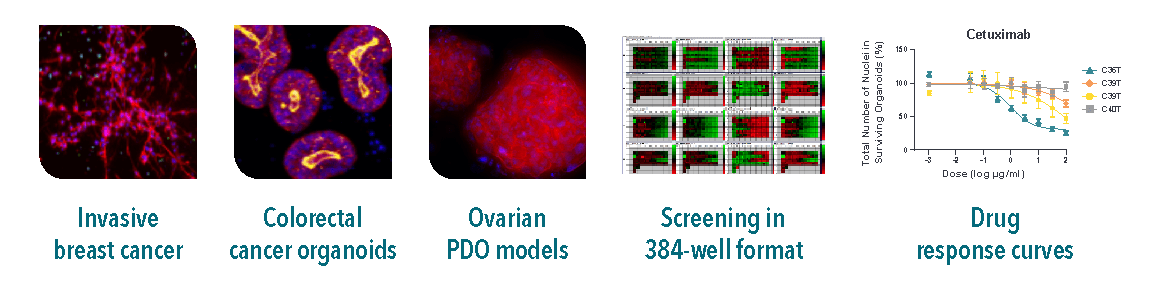 In Vitro High Content Imaging Solutions | Crown Bioscience