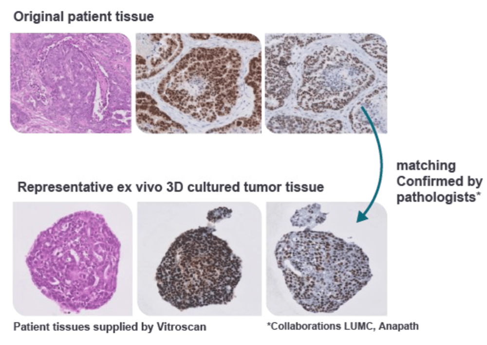 3D Ex Vivo Patient Tissue Platform | Crown Bioscience