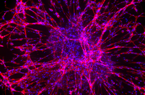 In Vitro High Content Imaging | Crown Bioscience