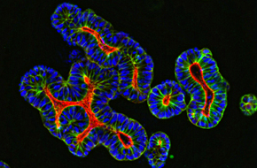 Innovative Model Systems for Preclinical Studies | Crown Bioscience