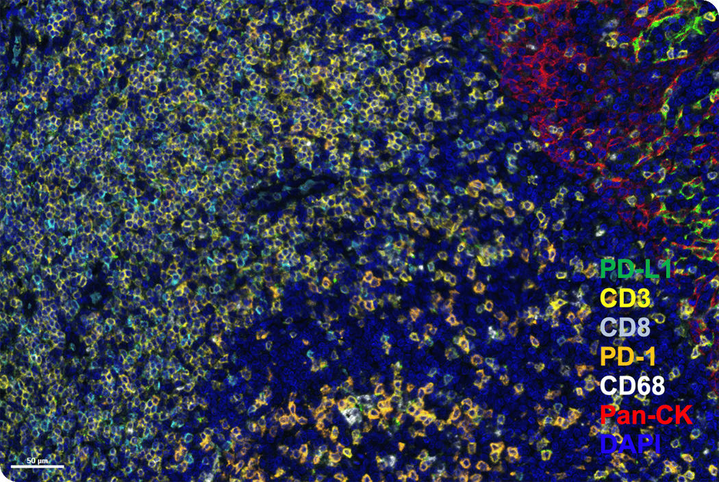 Advanced Digital Pathology & Histology for Biomarker Analysis | Crown ...