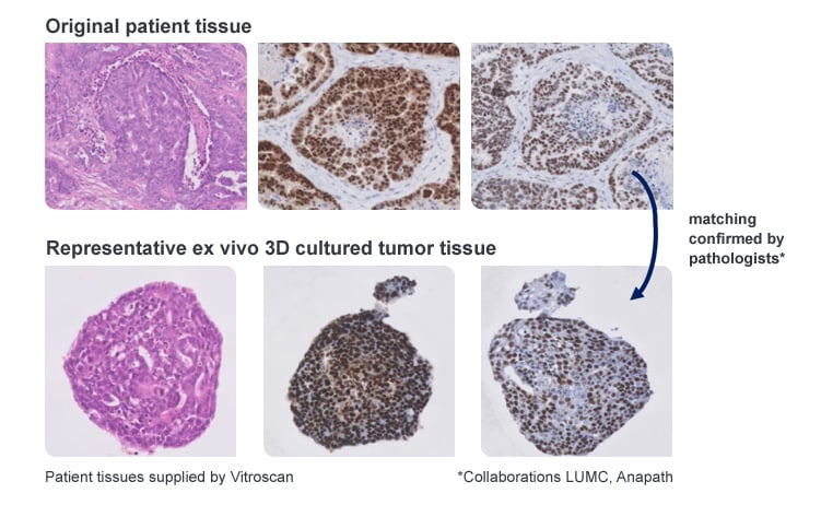 3D Ex Vivo Patient Tissue Platform | Crown Bioscience