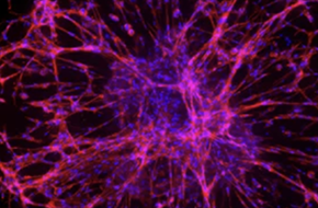 Innovative Model Systems for Preclinical Studies | Crown Bioscience