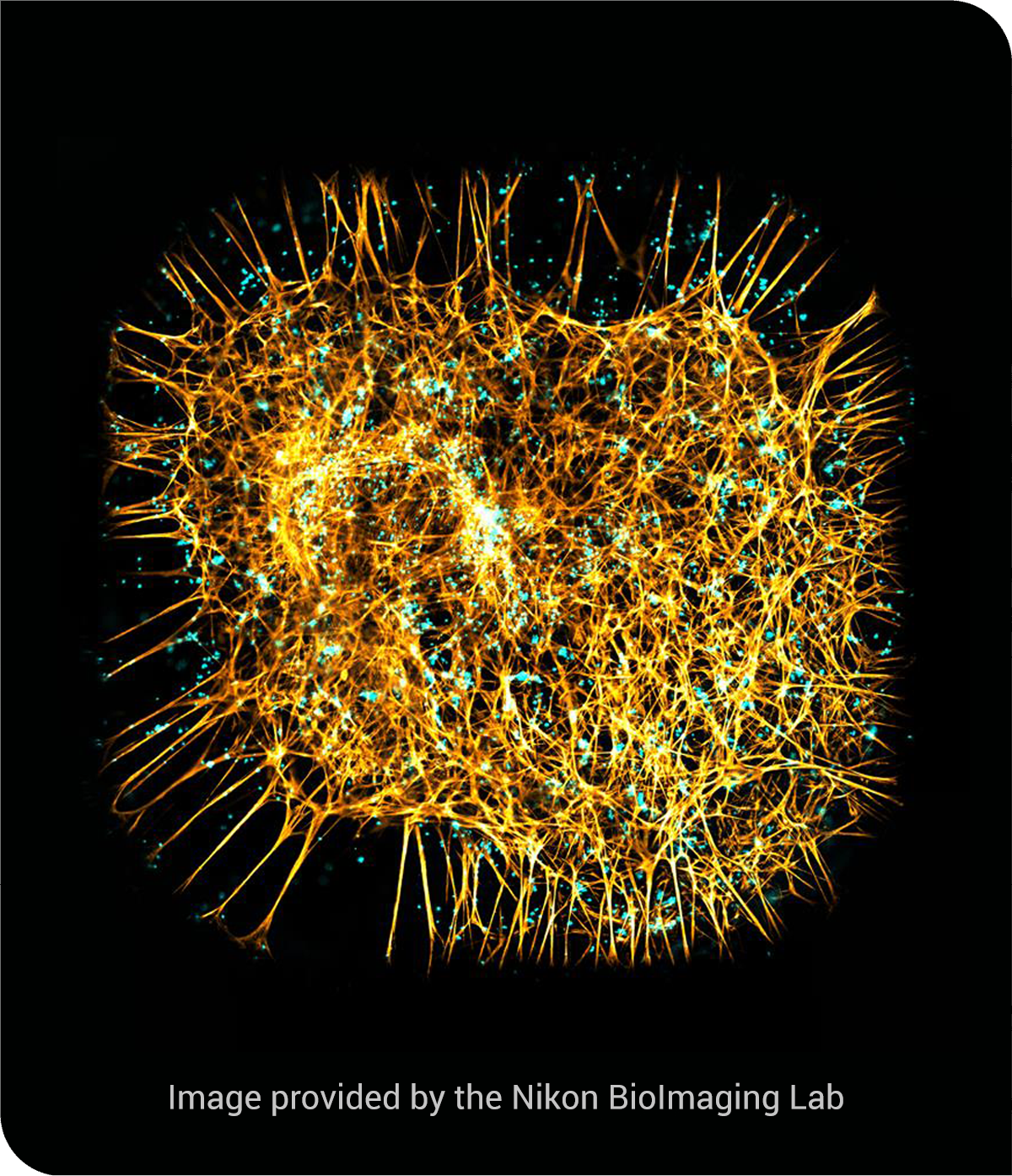 3D Bone Marrow Models: Transforming Drug Discovery for Hematopoietic ...