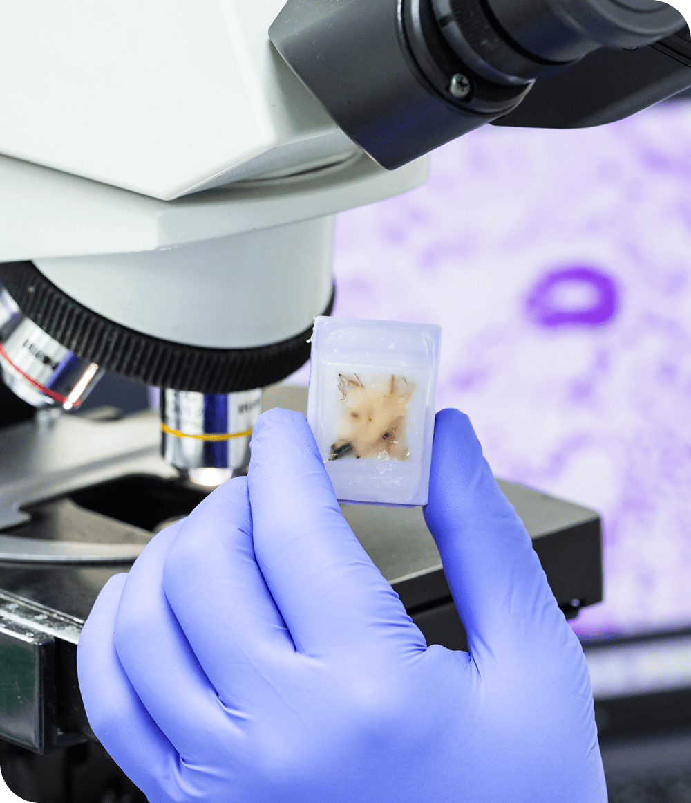 Human Biospecimen Solutions | Crown Bioscience