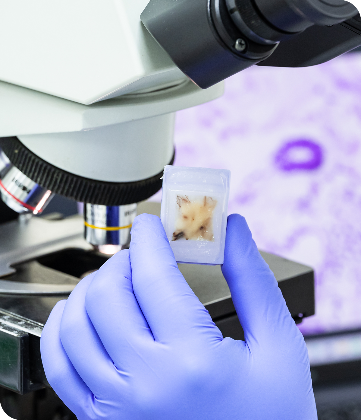 Human Biospecimen Solutions | Crown Bioscience