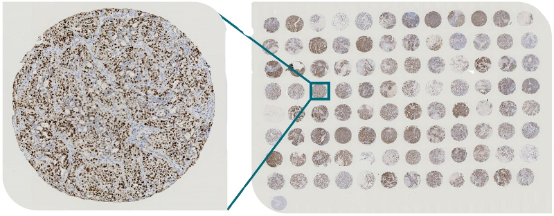 Tumor Tissue Microarrays | Crown BioScience
